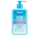 Acne Treatment | Acne Face Wash for Spots | Dermal Therapy